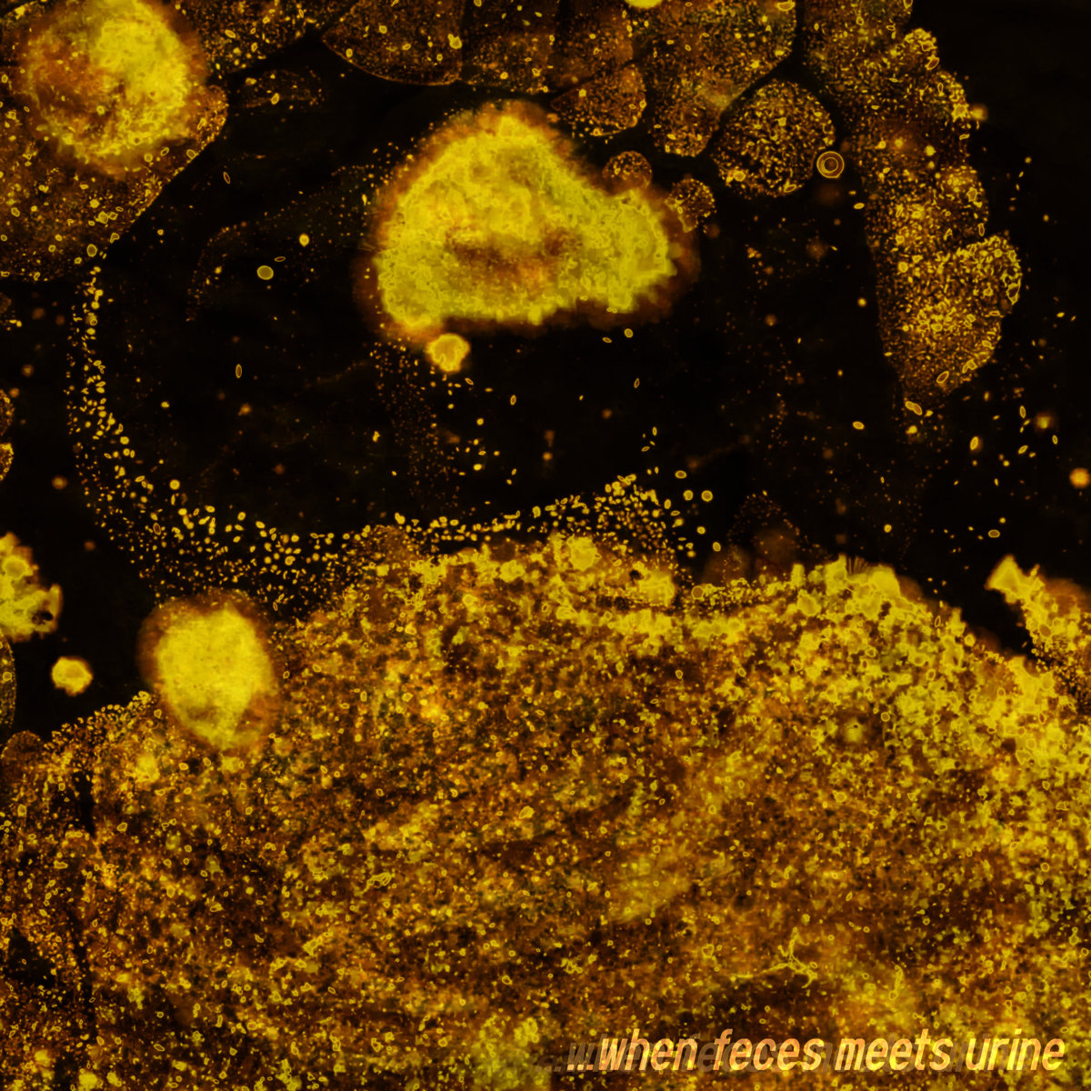 ...When Feces Meets Urine | Invasive Urinary Bacteria | Embalmer