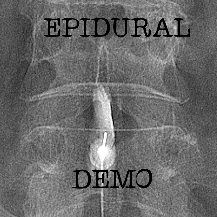 demo | Epidural