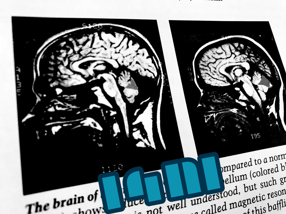 “Two Sides of the Same Brain” pt.2 | i4Ni | I4NI