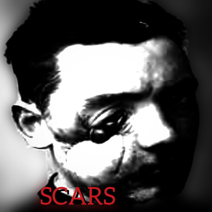Scars | The Merricks