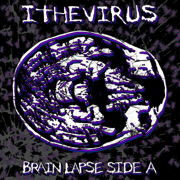 Brain Lapse Side: A | ItheVirus