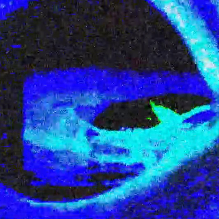 Whale_ | ORACLE.02000