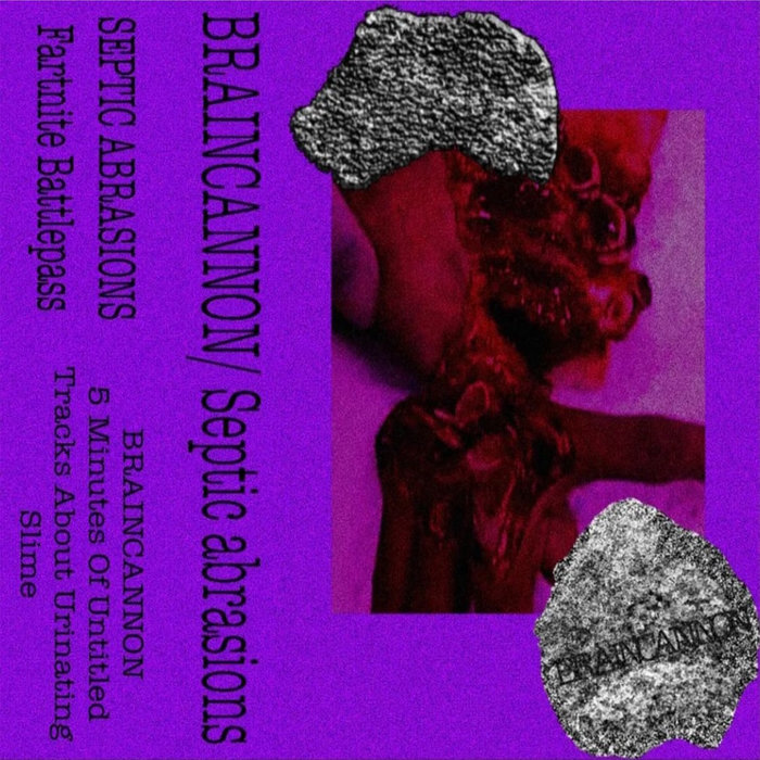 SPLIT WITH BRAIN CANNON | Septic Abrasions