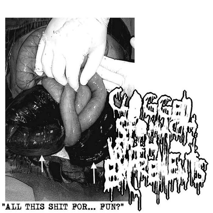 CLOGGED STOMACH WITH EXCREMENTS-ALL THIS SHIT FOR...FUN? EP | tapeworm ...