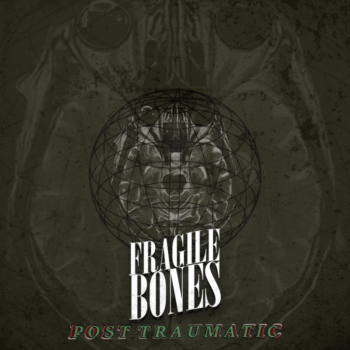 Post Traumatic | Fragile Bones