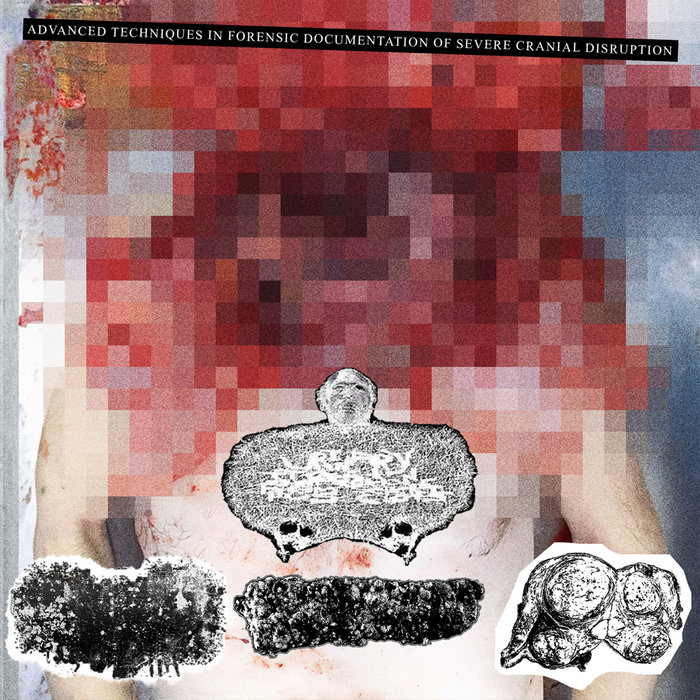 Advanced Techniques in Forensic Documentation of Severe Cranial ...