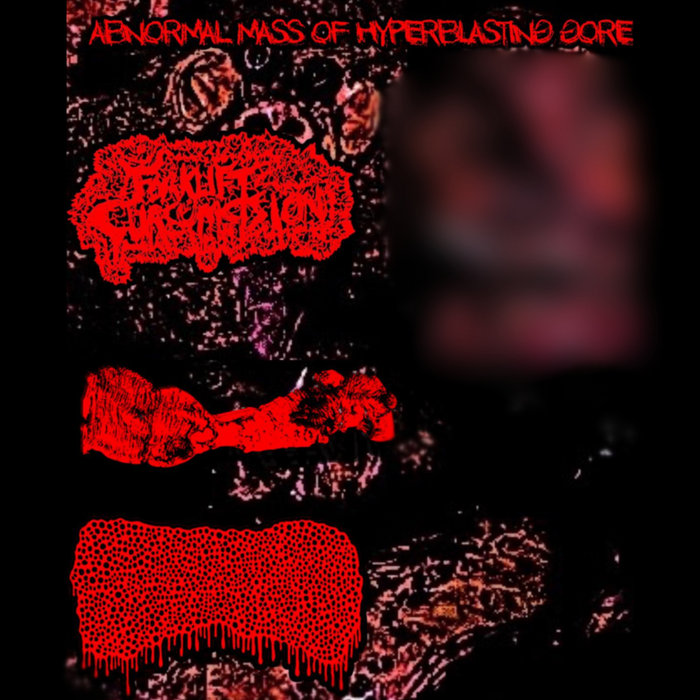 Abnormal Mass Of Hyperblasting Gore | Forklift Circumcision, Mycosis ...