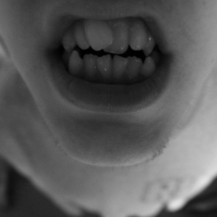 Chin Check EP | Volatile