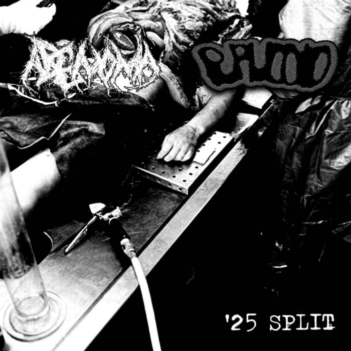 Adenoma / Puruloid Split | Puruloid, Adenoma | Puruloid