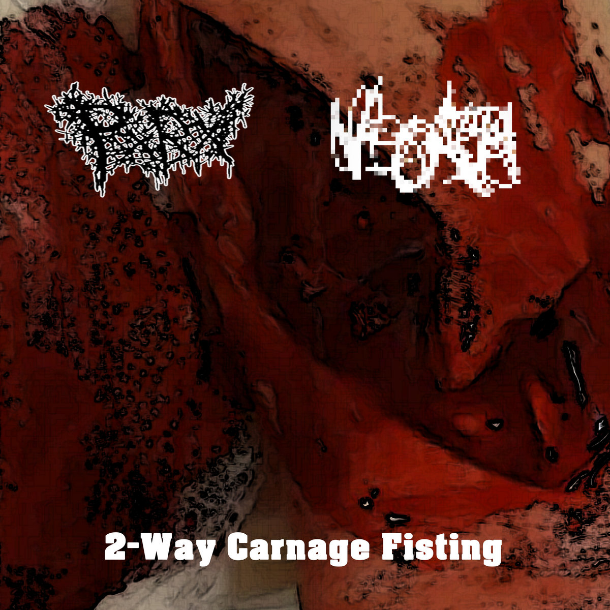 Polymyalgia Rheumatica / Vomit Beer on Aki Streeter's Rotten Corpse ...