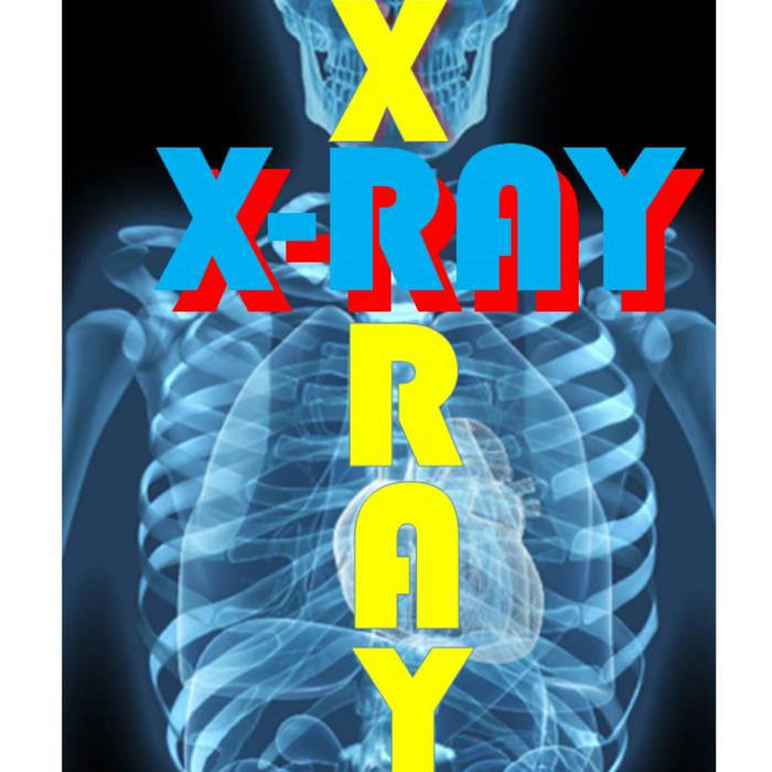 Music | Xray Xray
