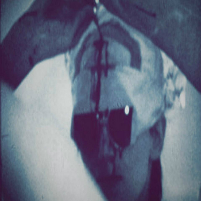 TREPANATION | SOUNDING