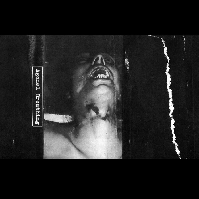 CASE:01 | Agonal Breathing