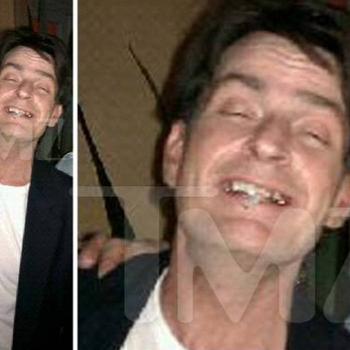 Charlie Sheen Teeth