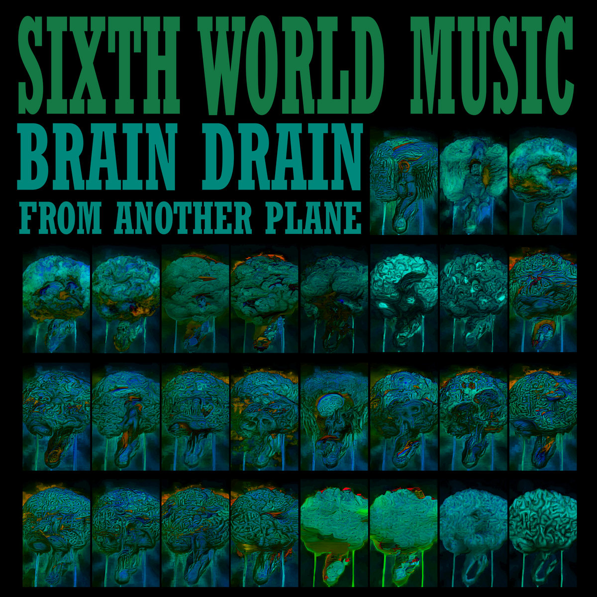 Brain Drain In The World