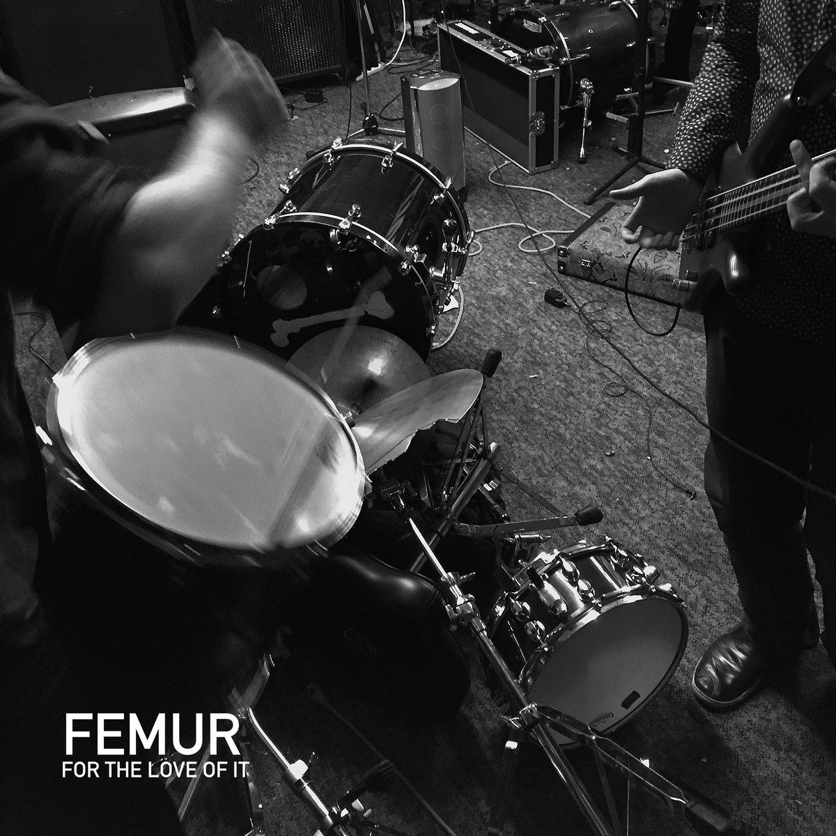 Head Of Femur Band