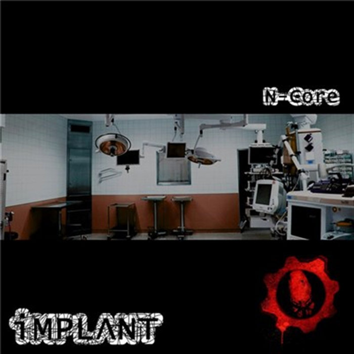 Noise Core | Implant (7)