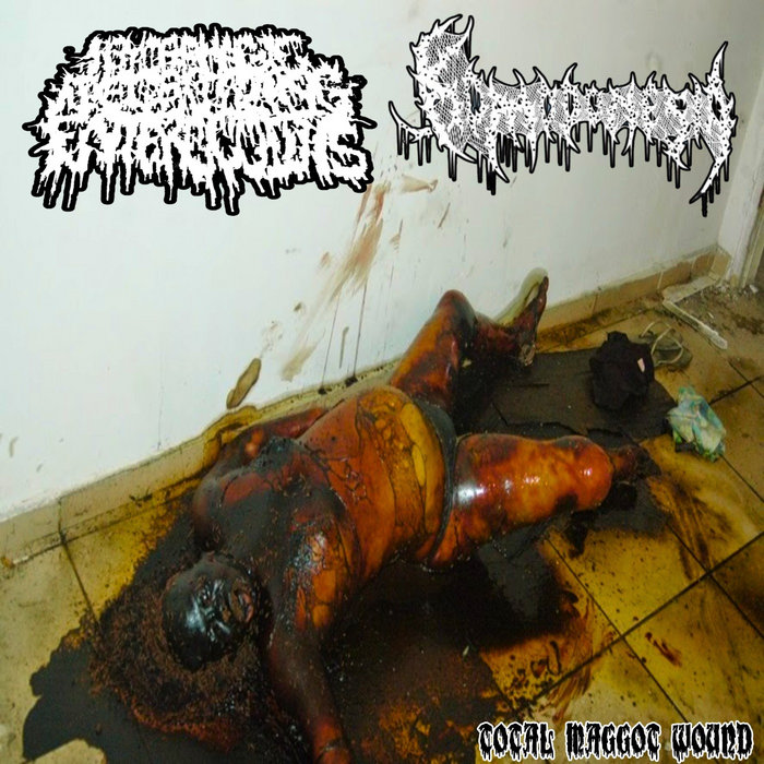Total Maggot Wound-Split w/ Komodonesia | Hemorrhagic Necrotizing ...