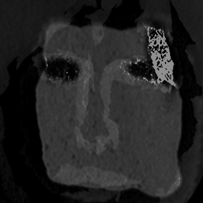 UNMITIGATED DISASTER | inanition