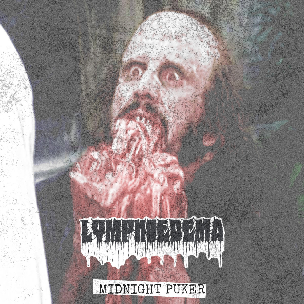 Midnight Puker | Lymphoedema