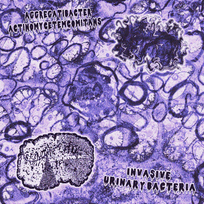 Contracted Multiple Sexually Transmitted Diseases via Shared Catheters ...