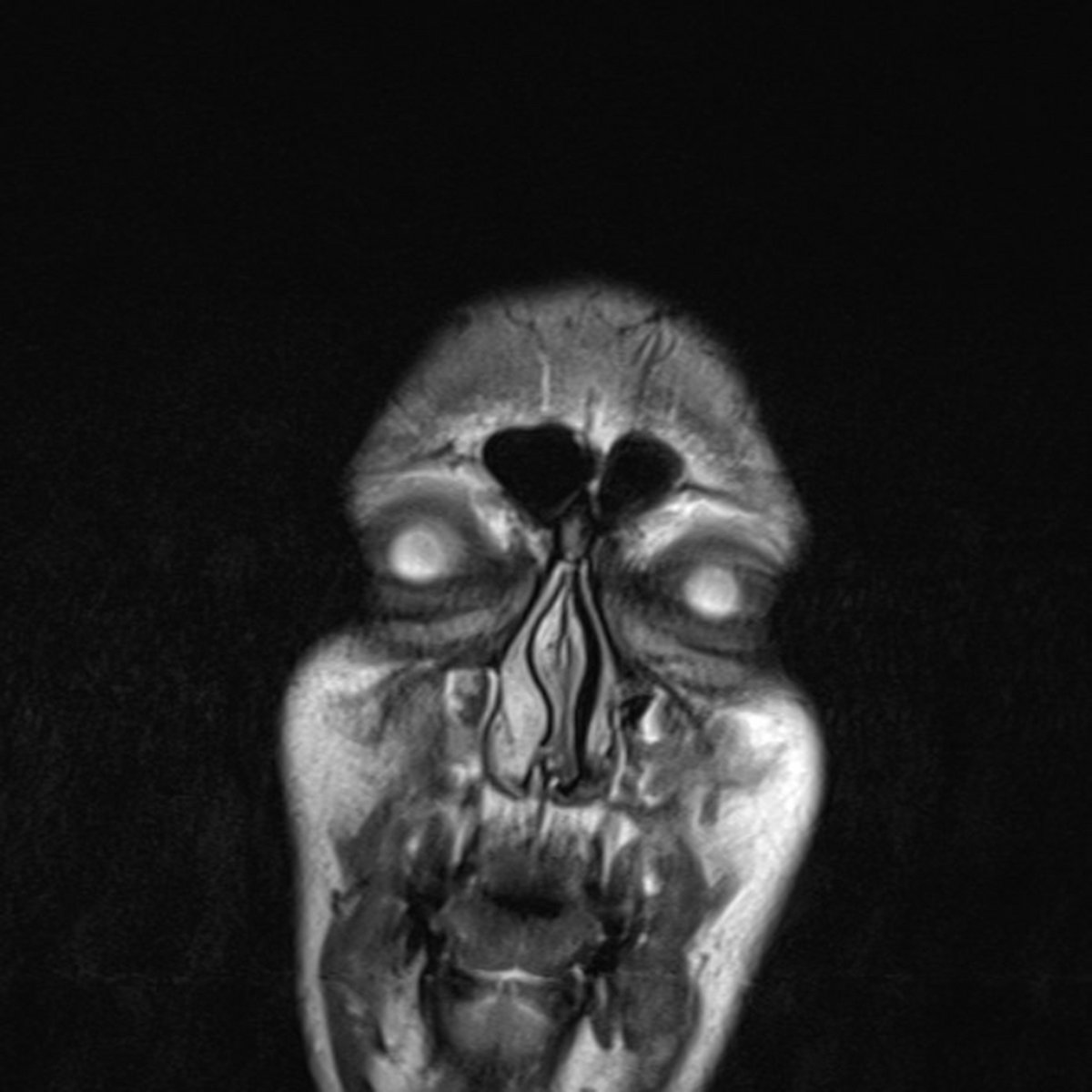 The Jacksonian March | GRIFTEFÄRD