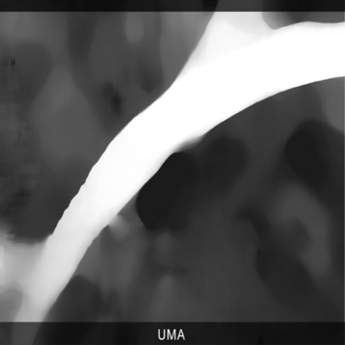 UMA | UMA