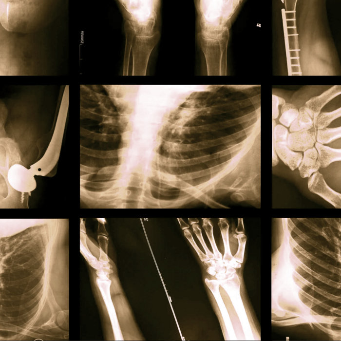 Injury | crazy alien