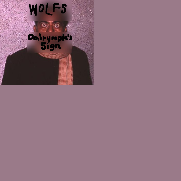 Dalrymple's Sign | Wolfs