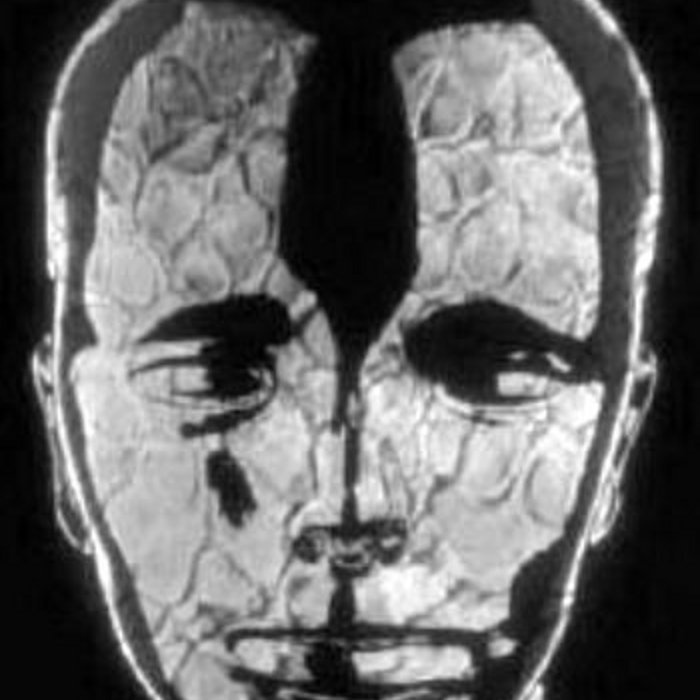 Terminal Man | wirewall