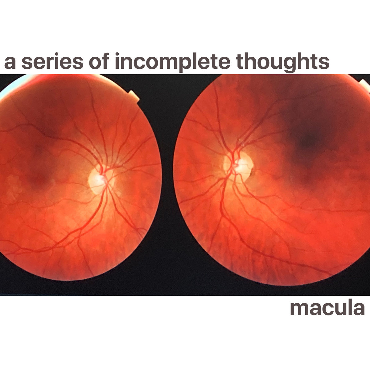 Macula | A Series of Incomplete Thoughts