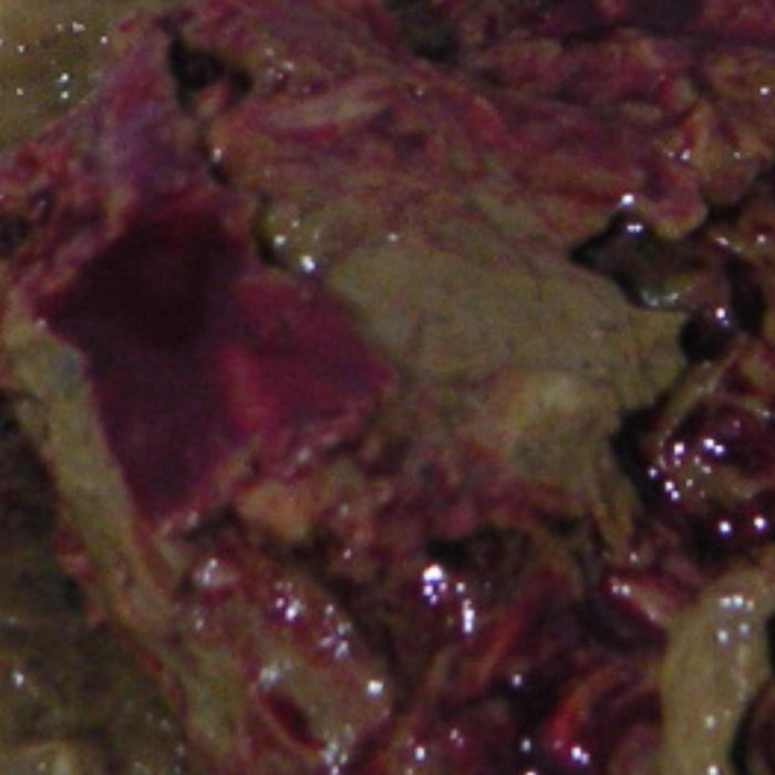 Hematochezia Specimens | BLOOD BURSTER