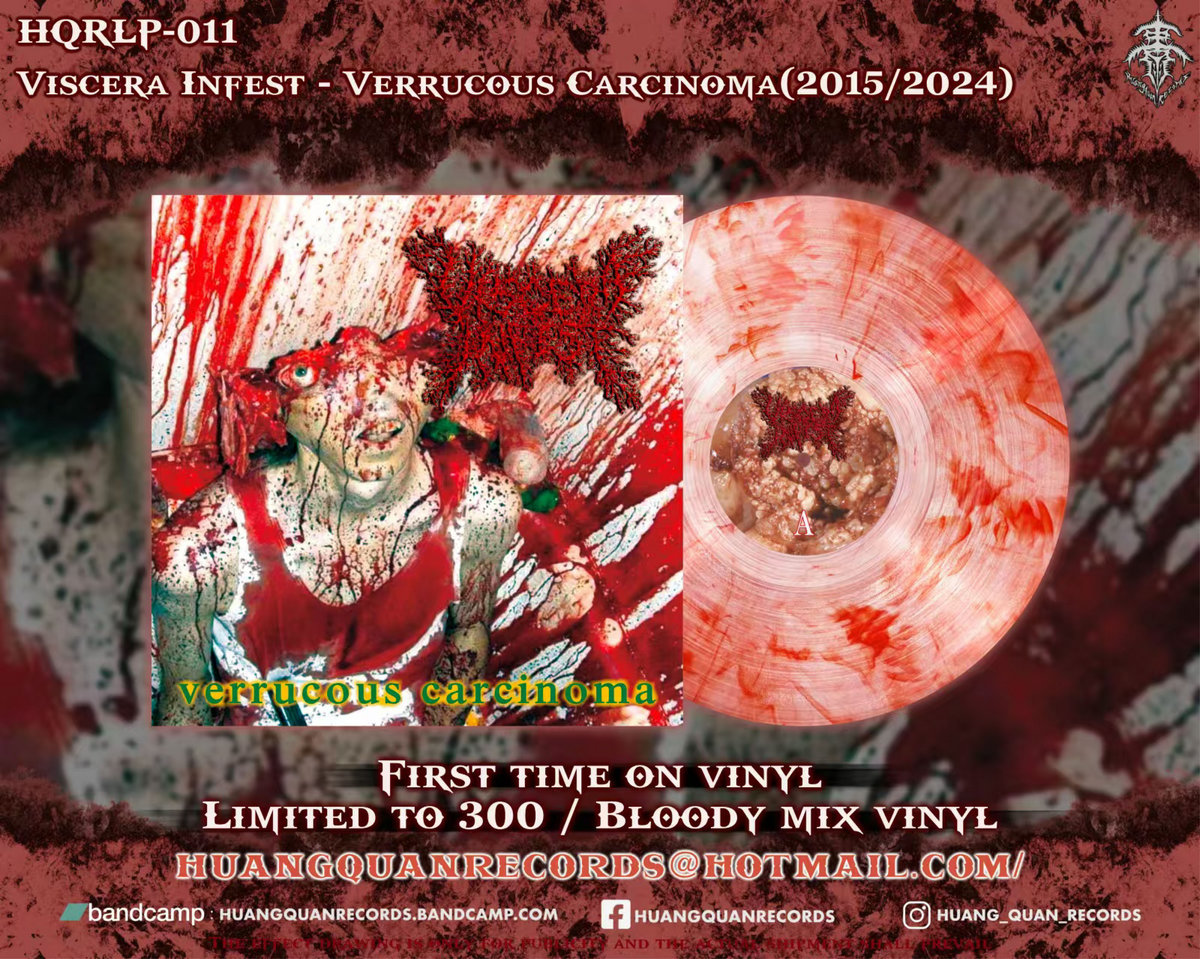HQRLP - 011 Viscera Infest – Verrucous Carcinoma | Huangquan Records