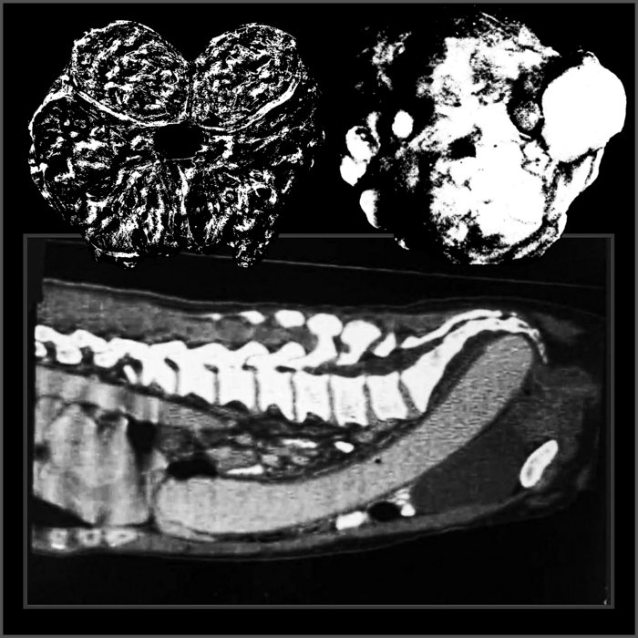 SPLIT W/ GASTROPARESIS | MORBID ANUS | DESICCATED FLESH COLLECTIVE