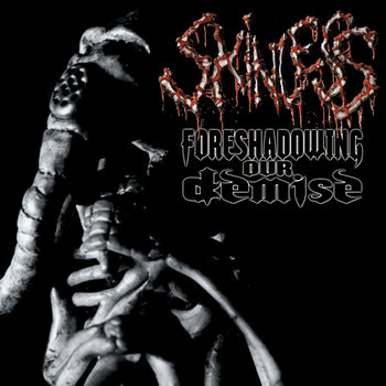 Music | Skinless