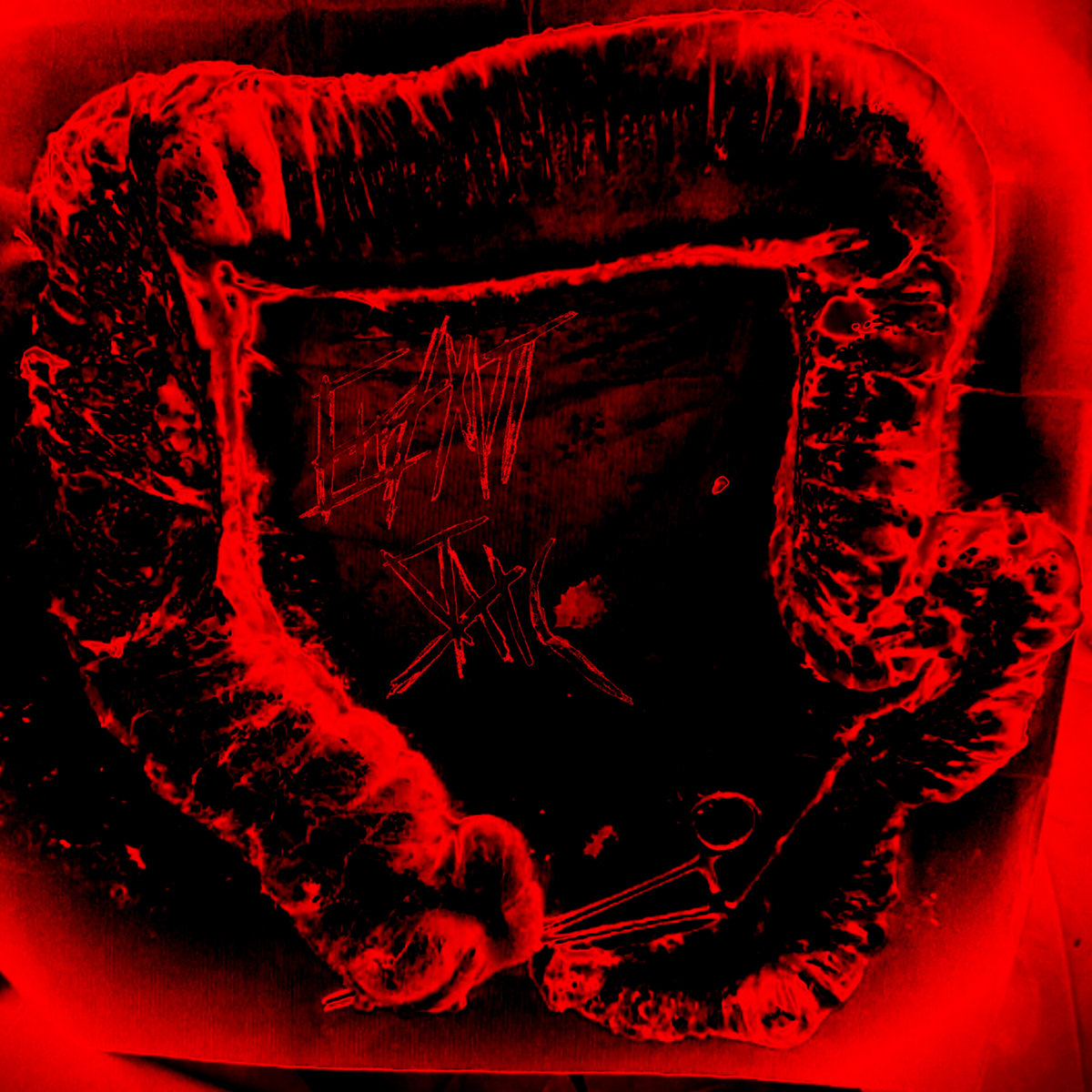 Total Organ Rejection | Errant Static