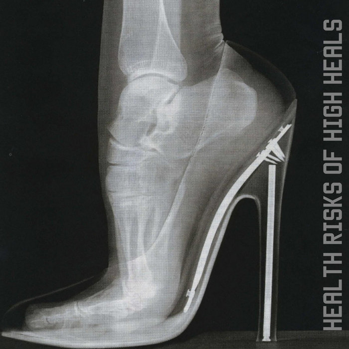 Health Risks of High Heals | Dry Birth Records