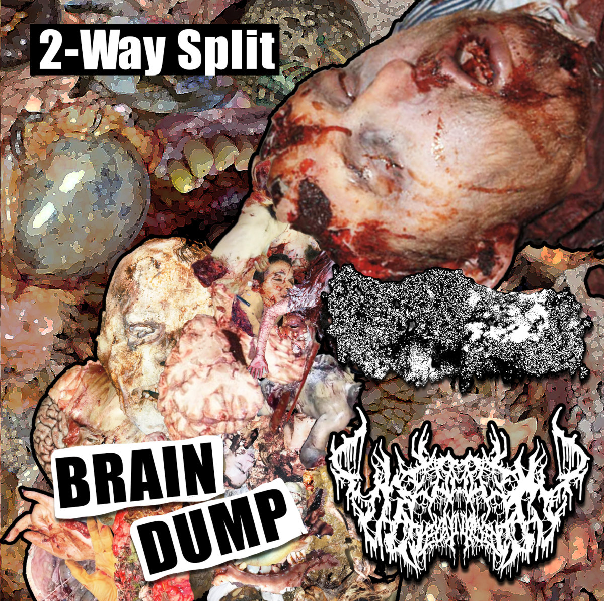 BRAIN DUMP (Split W/ VILE FLESH DECAYING REMAINS) | Syphilitic Brain Rot