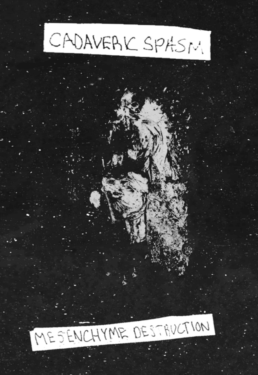 Mesenchyme Destruction | Cadaveric Spasm | Embalmer