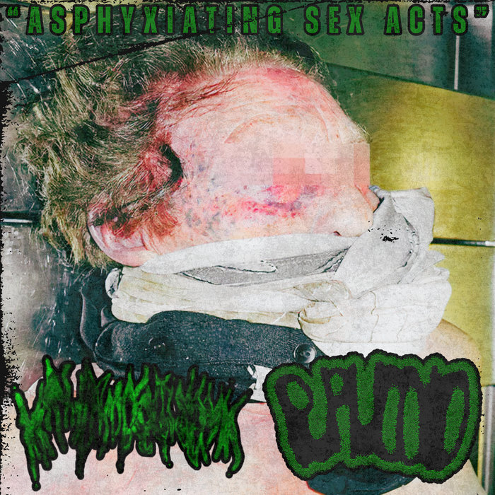 (Puruloid) Sloppily Severed Human Remains | Methemoglobenemia, Puruloid ...