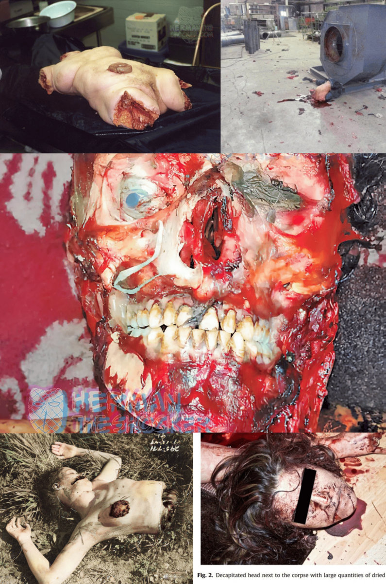 Attempt To Dispose Of a Body By Mutilation And Disarticulation | HxAx