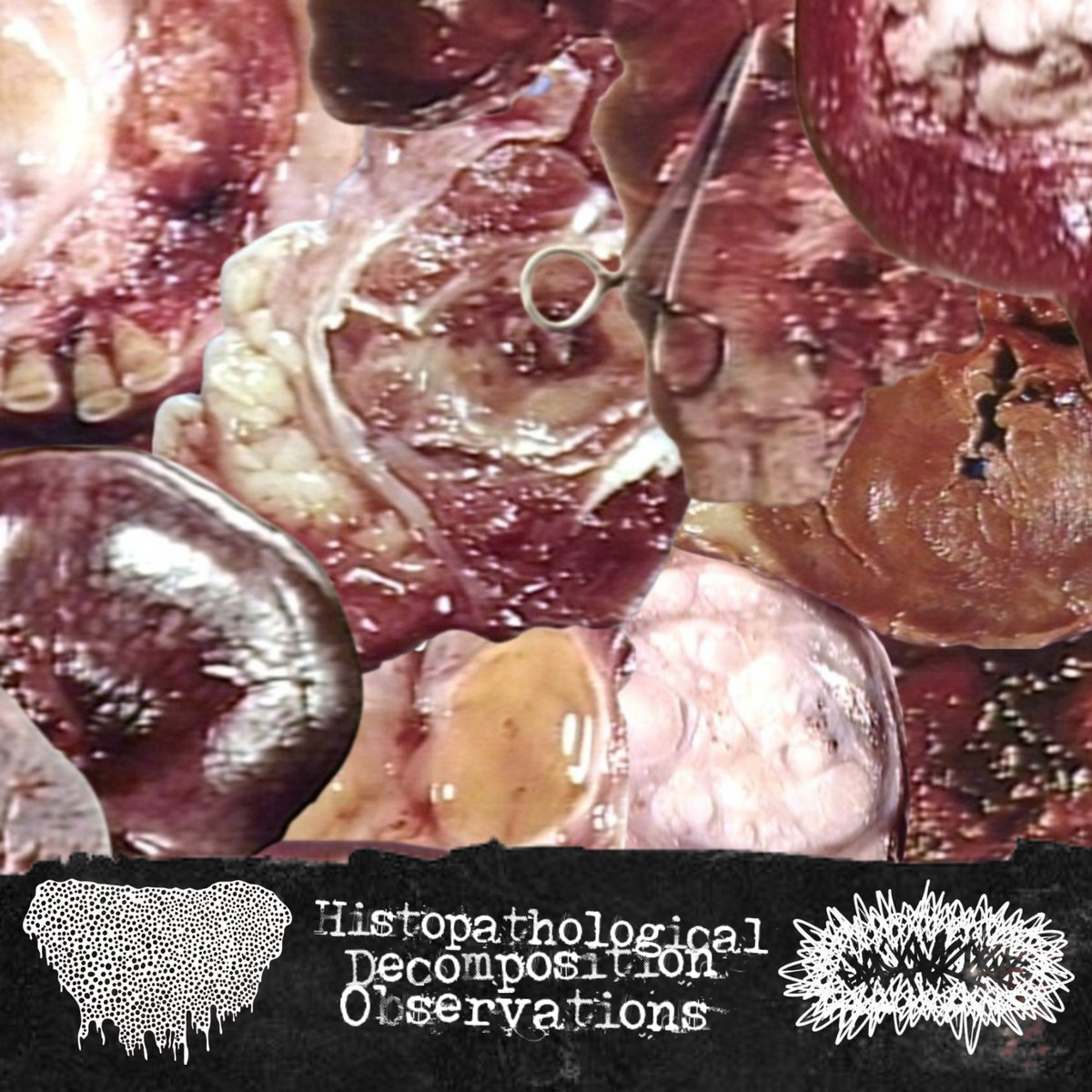 Bloody Bukkake - Clinical Degeneration of Post-Mortem Flesh ...