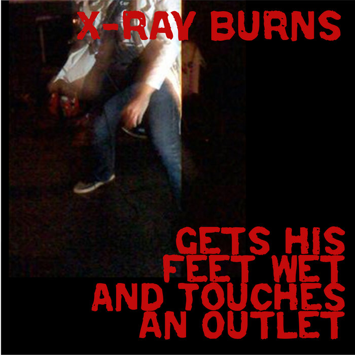 Gets His Feet Wet and Touches an Outlet | X-Ray Burns