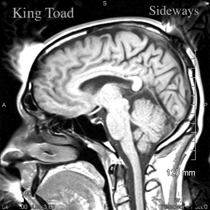 Sideways | King Toad