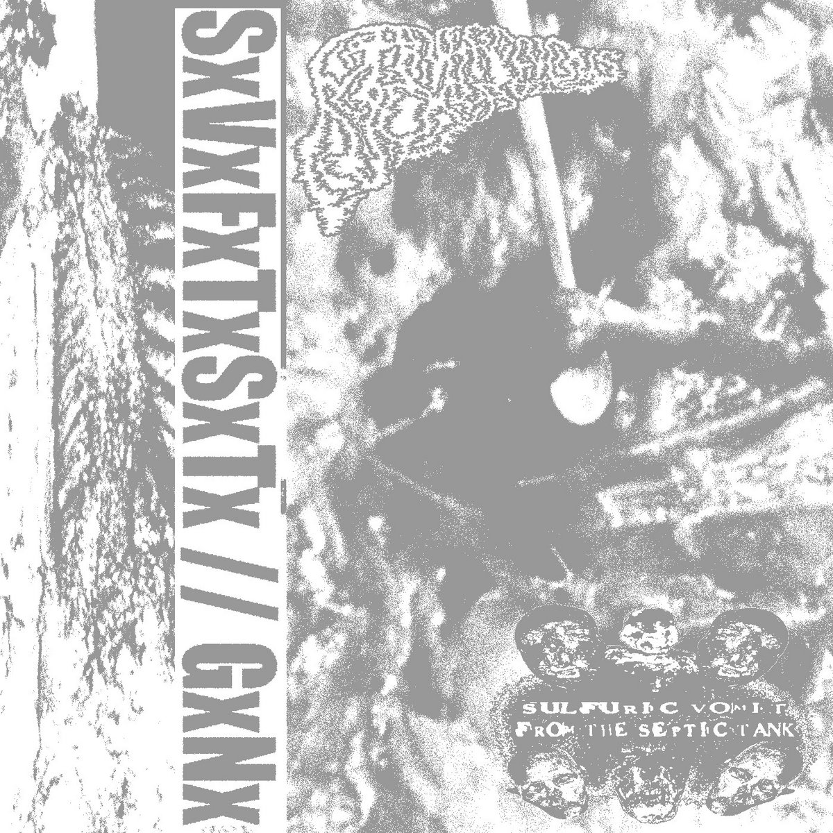 Sulfuric Vomit From The Septic Tank / Gangrenous Necrosis Split ...