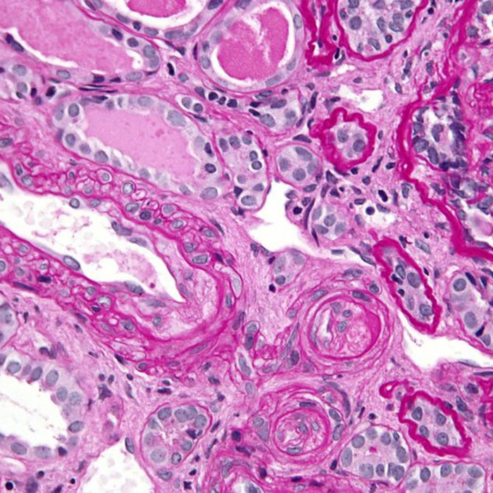 Shitty phone demo | Sticky Blood