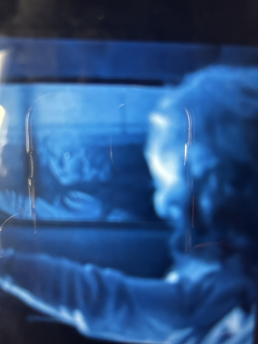 Skeleton Dance | Distant Hands