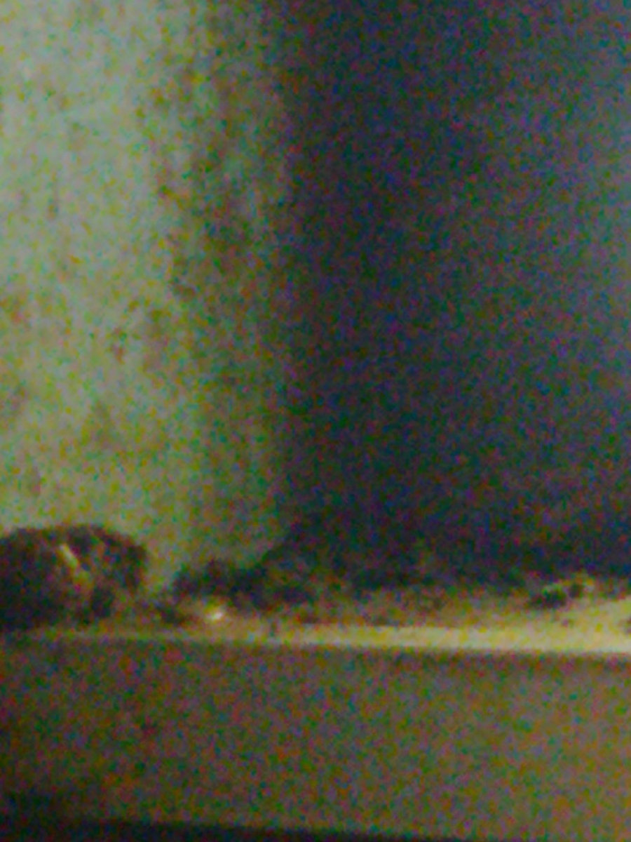 Psychogenic excoriation | Pask