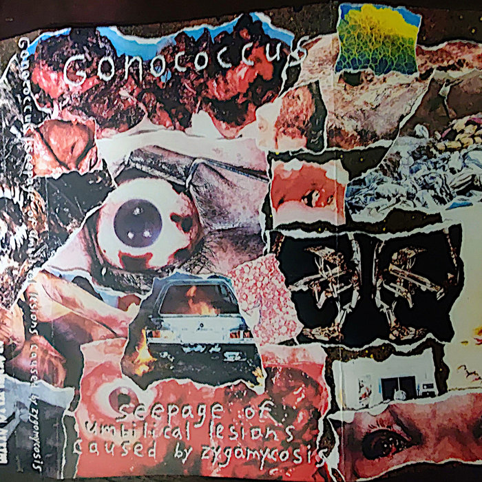 from split tape with Gonococcus (Sickening Shit, 2022) | Seepage Of ...