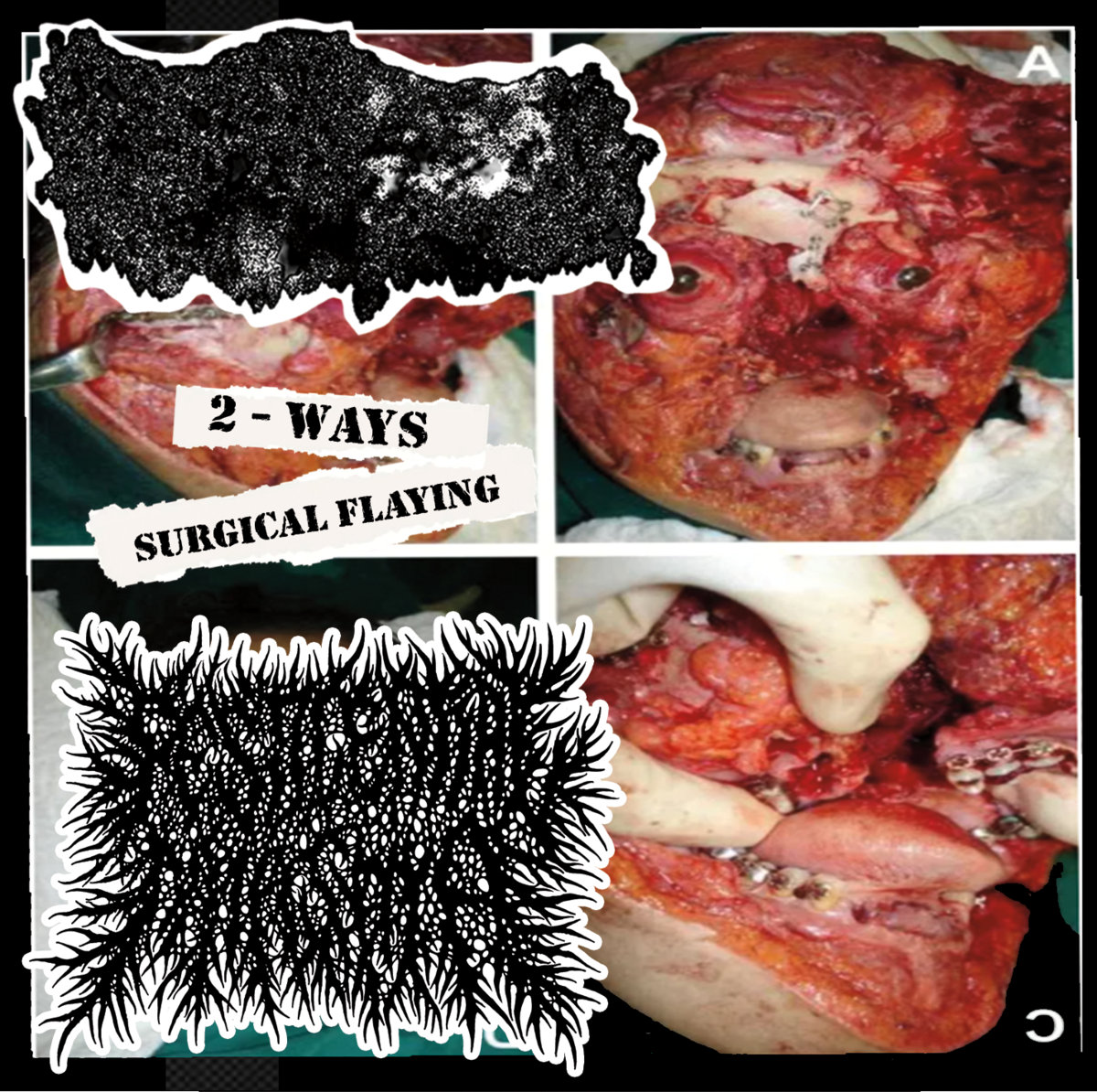 2-Ways Surgical Flaying - Split W/ PESTILENTIAL MIASMA | Syphilitic ...
